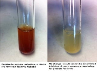 Nitrate reductase test and oxidation-fermentation test.pptx