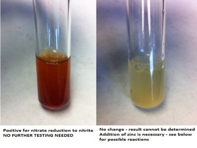 Nitrate reductase test and oxidation-fermentation test.pptx
