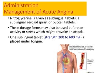 Nitroglycerine drug. ppt | PPTX
