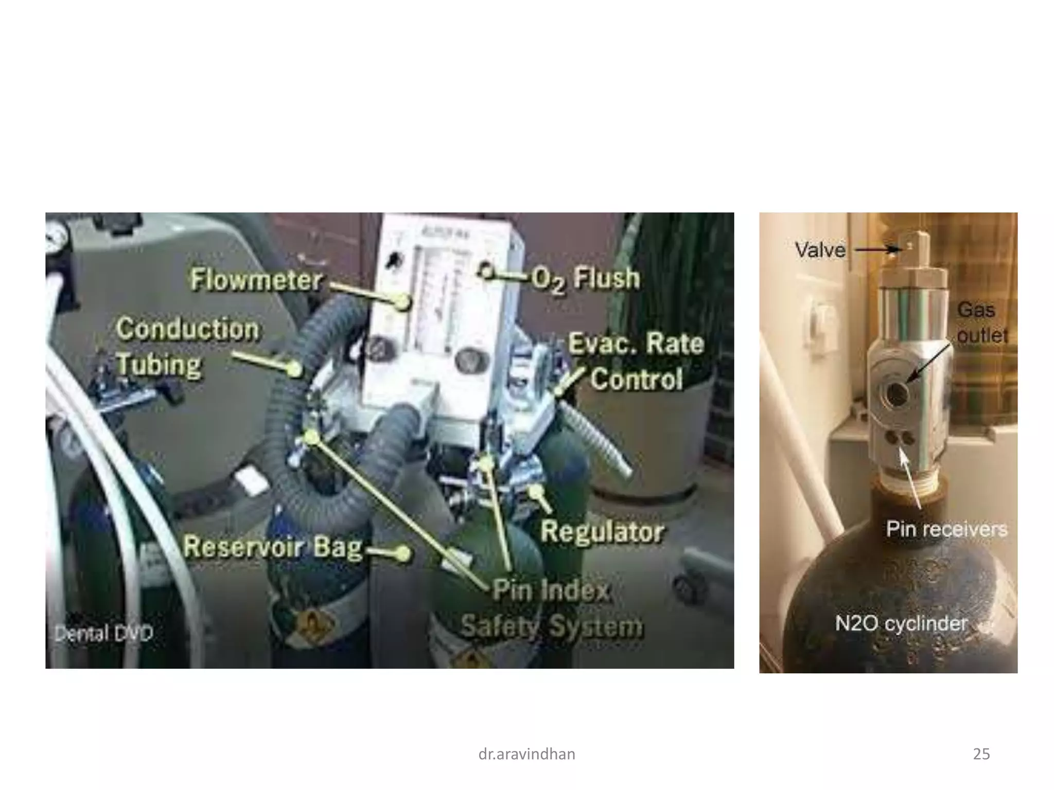 Nitrous oxide inhalation sedation | PPTX