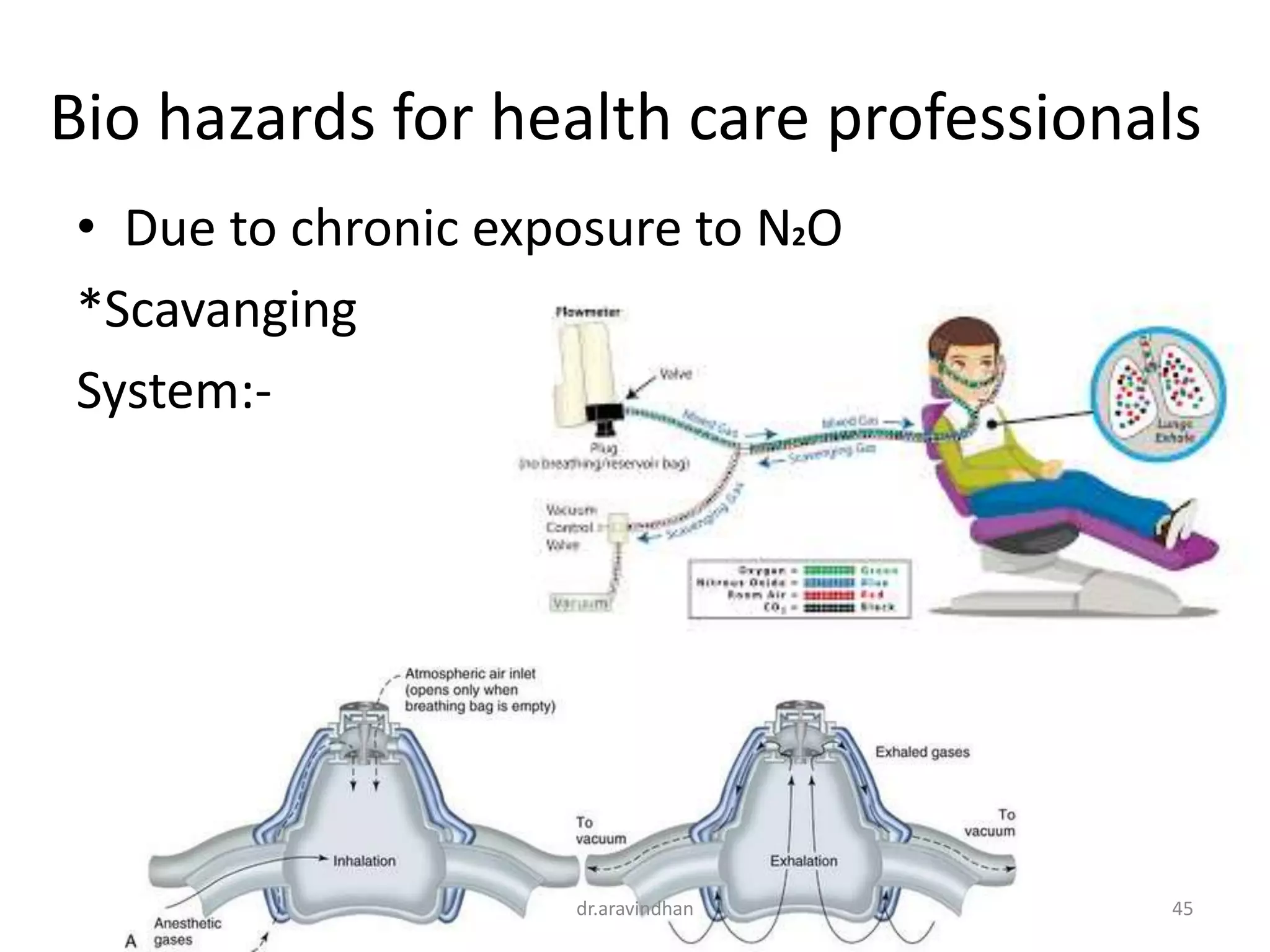 Nitrous oxide inhalation sedation | PPTX