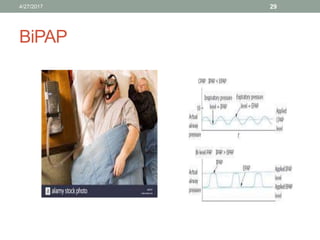 Non Invasive Ventilation | PPTX