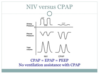 Non Invasive Ventilation Update | PPT