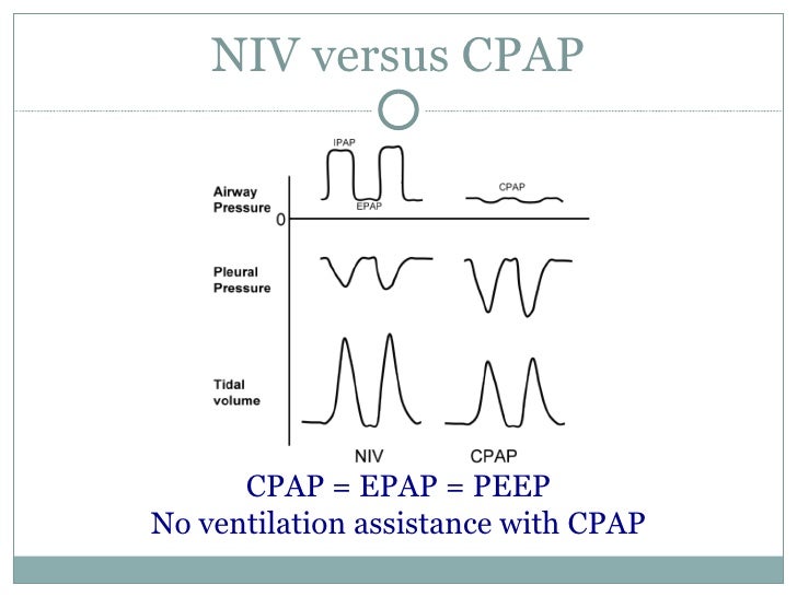 Non Invasive Ventilation Update