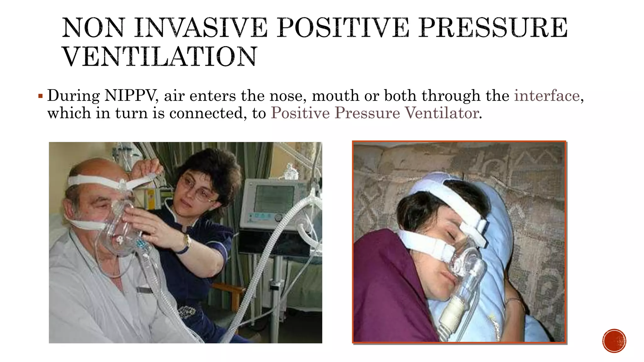 NIV (Non Invasive Mechanical Ventilation) | PPSX