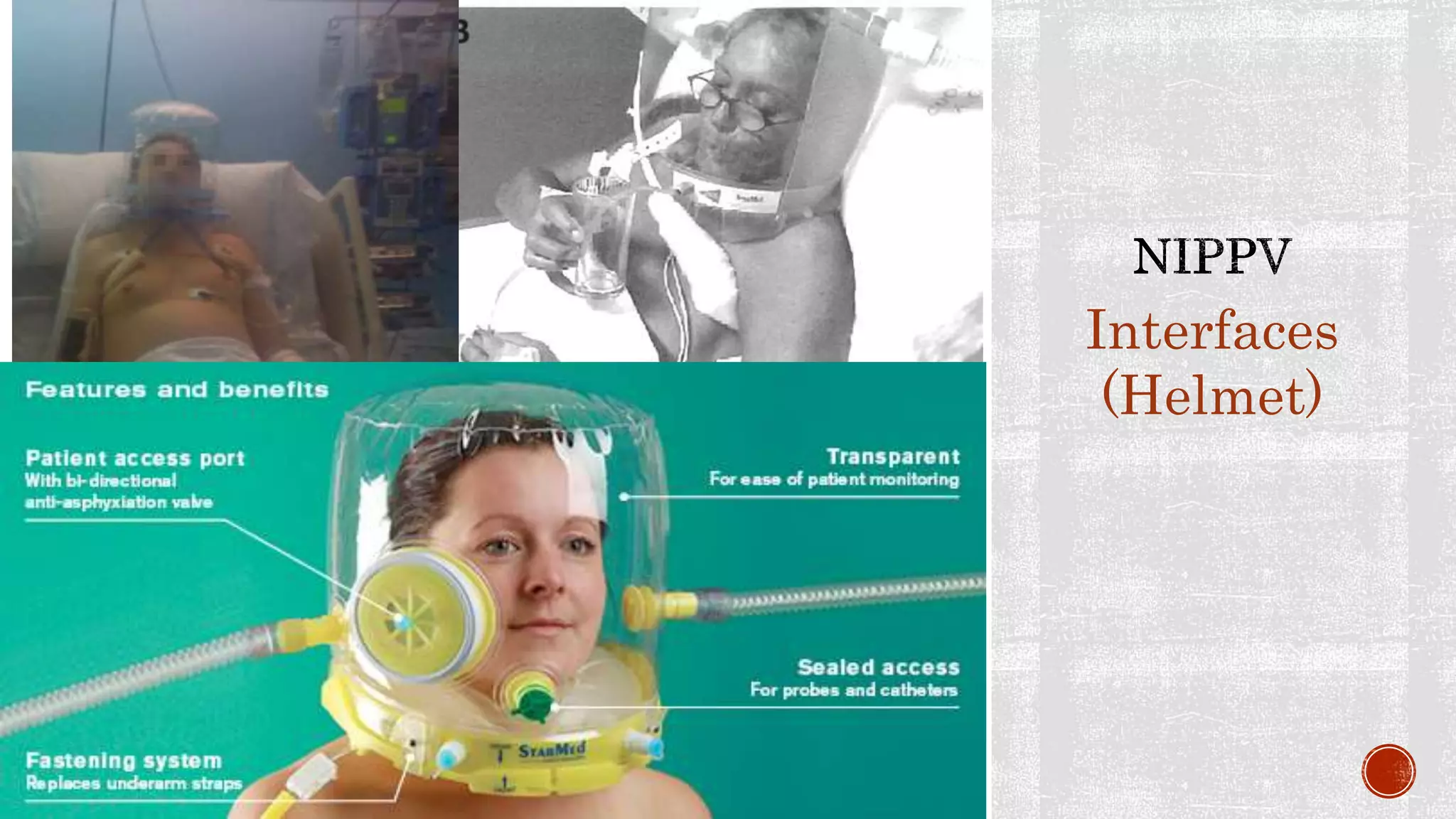 NIV (Non Invasive Mechanical Ventilation) | PPSX