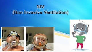 Non Invasive Ventilation and Masks | PPTX