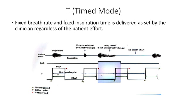 Non Invasive Ventilation (NIV) | PPTX