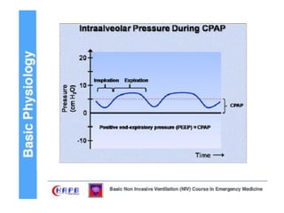 Niv practice update | PPT