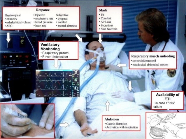 Non invasive ventilation for nurses-dr Shahna Ali,JNMC,AMU | PPT