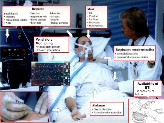 Non invasive ventilation for nurses-dr Shahna Ali,JNMC,AMU