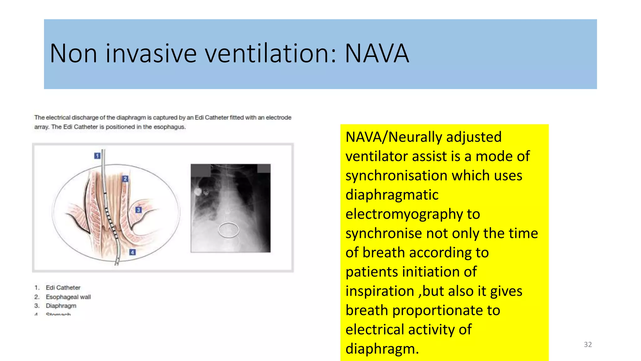 NON INVASIVE VENTILATION IN NEONATES-PART 2 | PPTX