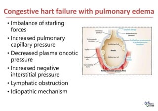 NIV in CHF | PPT