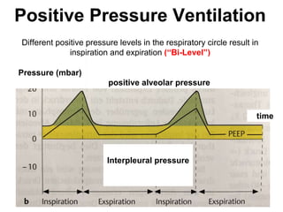 Non invasive ventilation (NIV) in low resource settings | PPTX