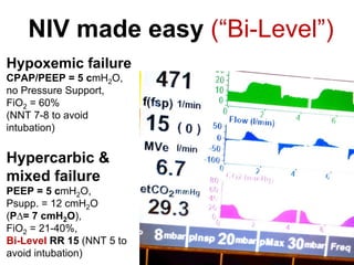 Non invasive ventilation (NIV) in low resource settings | PPTX