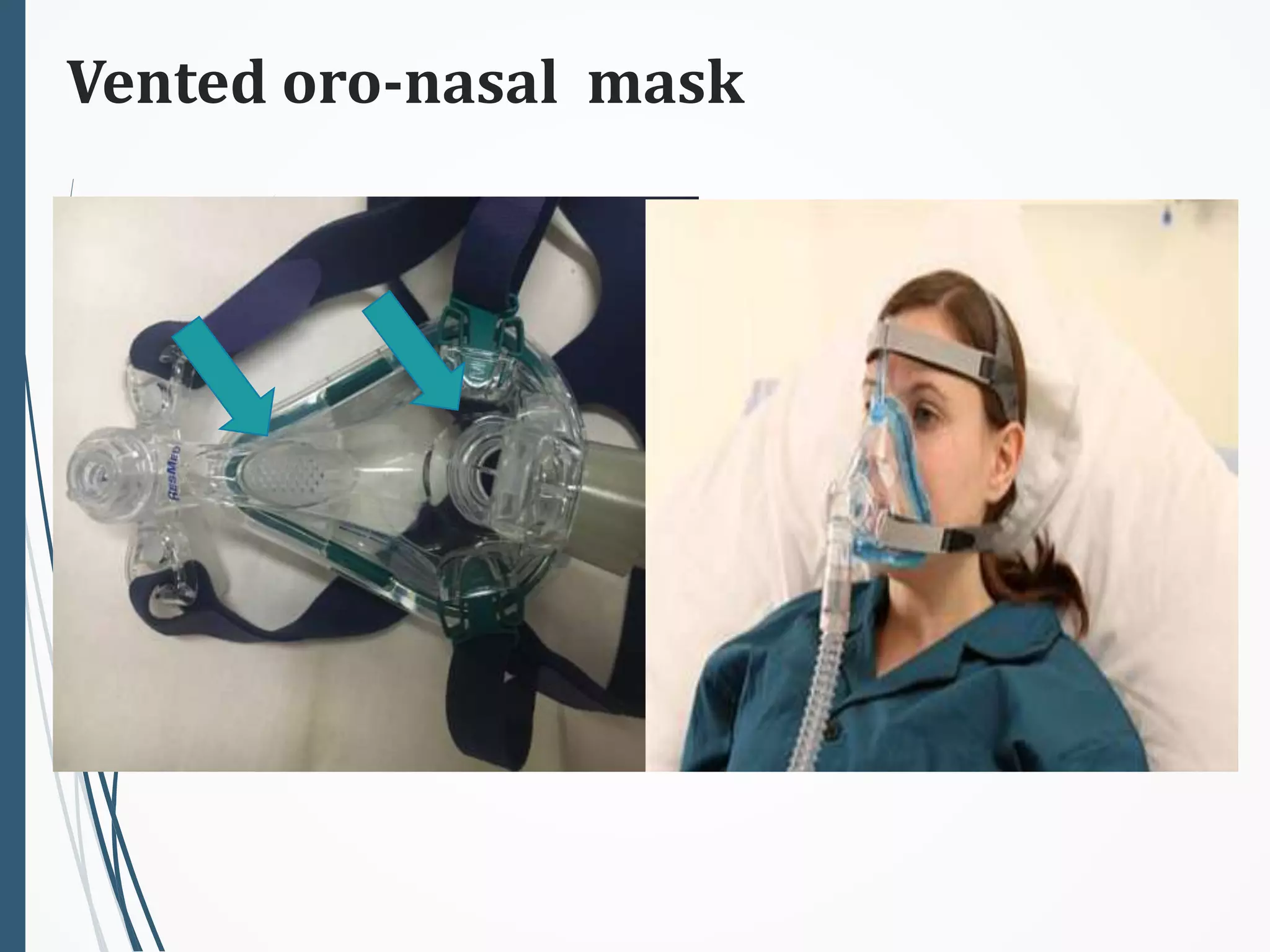 Niv(non invasive ventilation) aiims ppt | PPTX