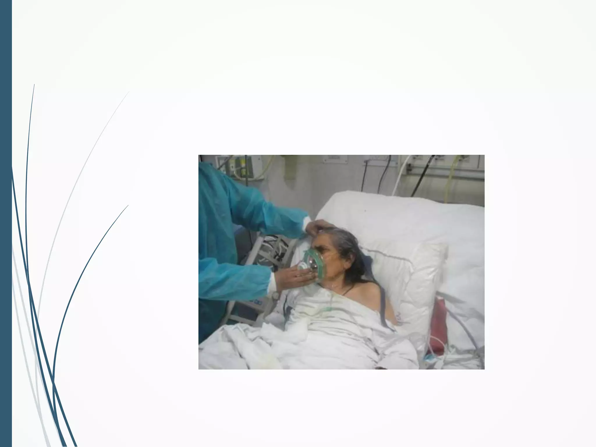 Niv(non invasive ventilation) aiims ppt | PPTX