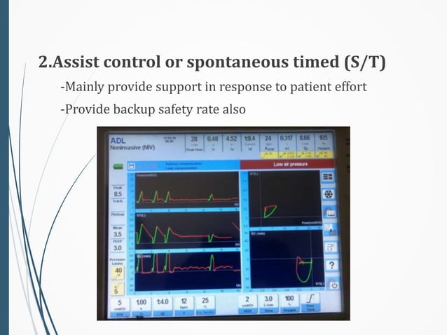 Niv(non invasive ventilation) aiims ppt | PPTX