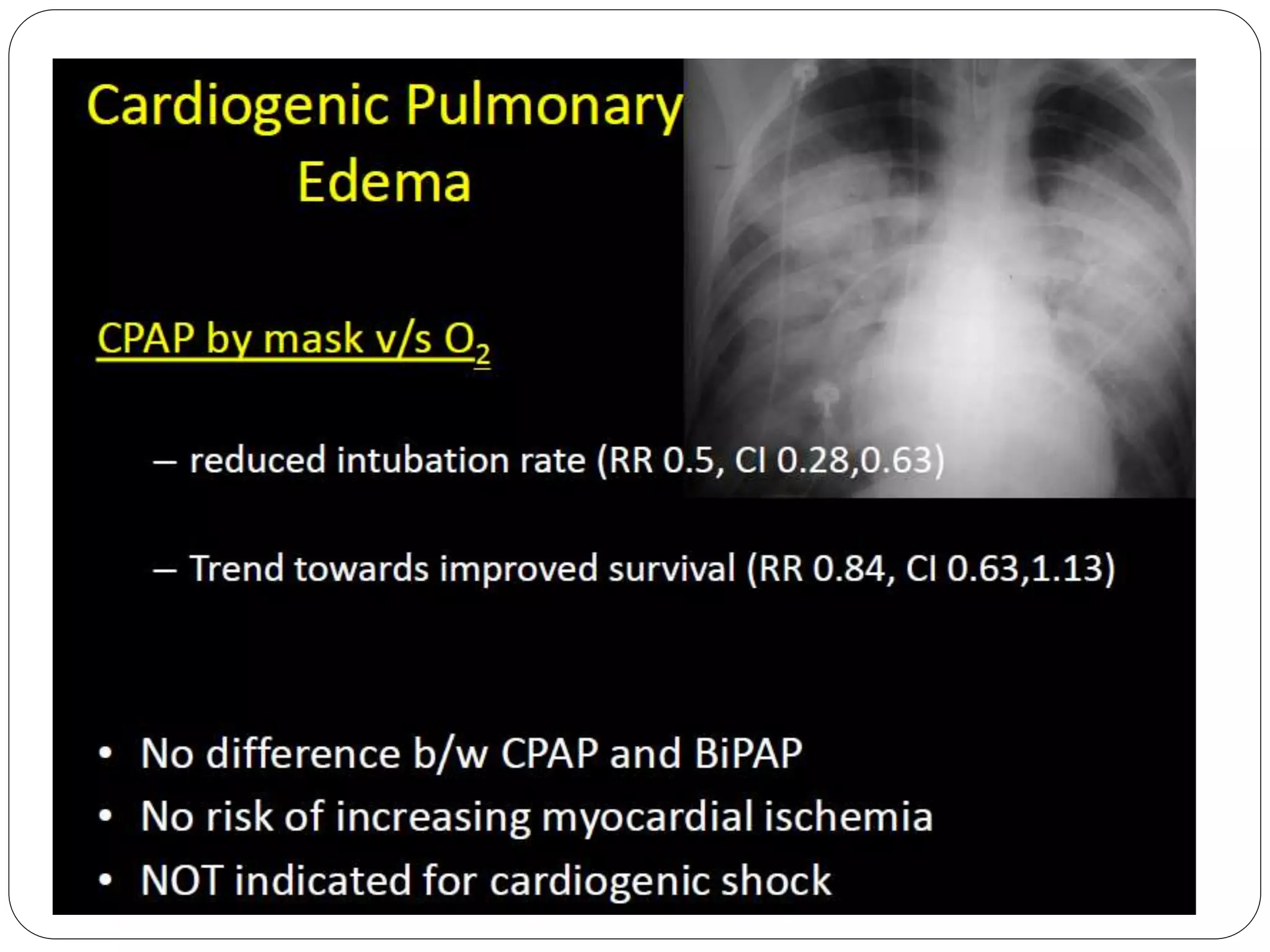 NIV(NON INVASIVE VENTILATION) | PPT