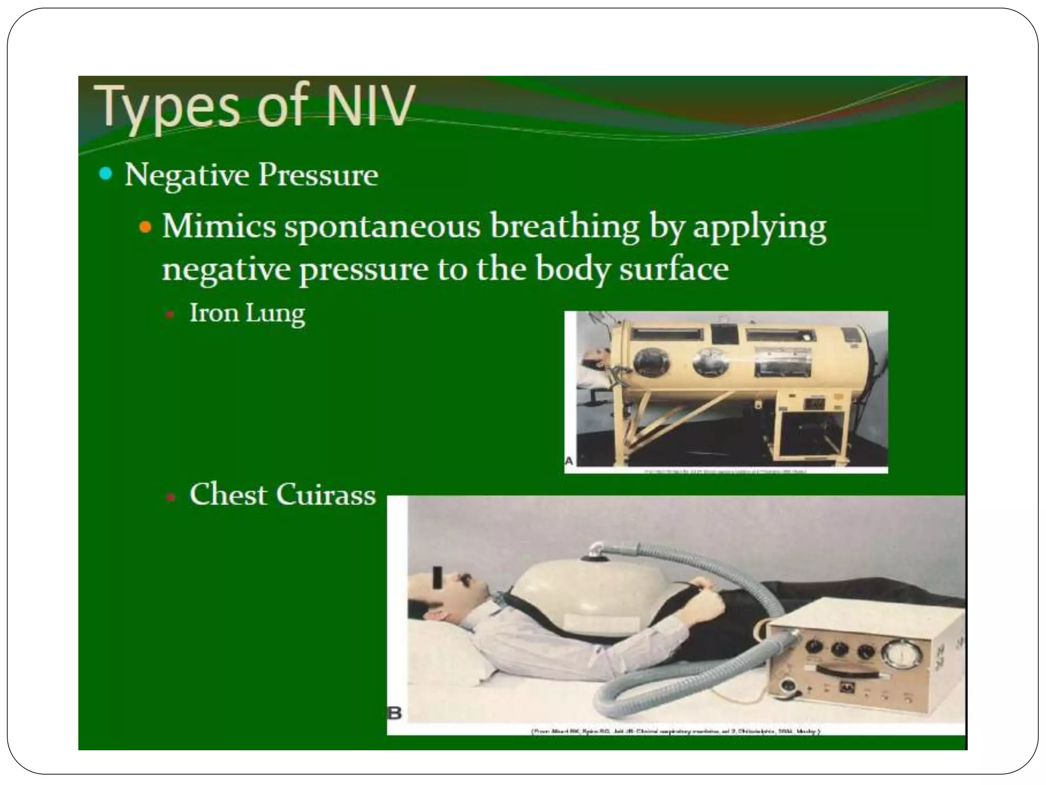 NIV(NON INVASIVE VENTILATION) | PPT