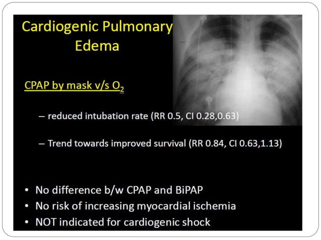 NIV(NON INVASIVE VENTILATION) | PPT