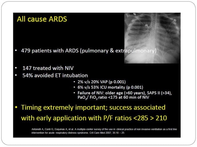 NIV(NON INVASIVE VENTILATION) | PPT