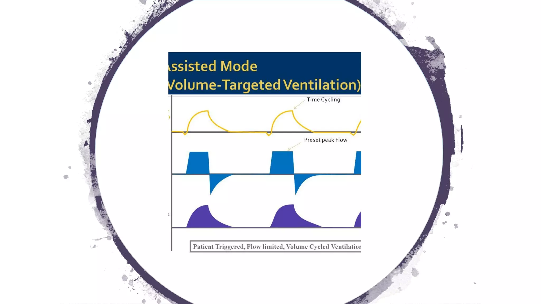Niv ventilatory modes | PDF