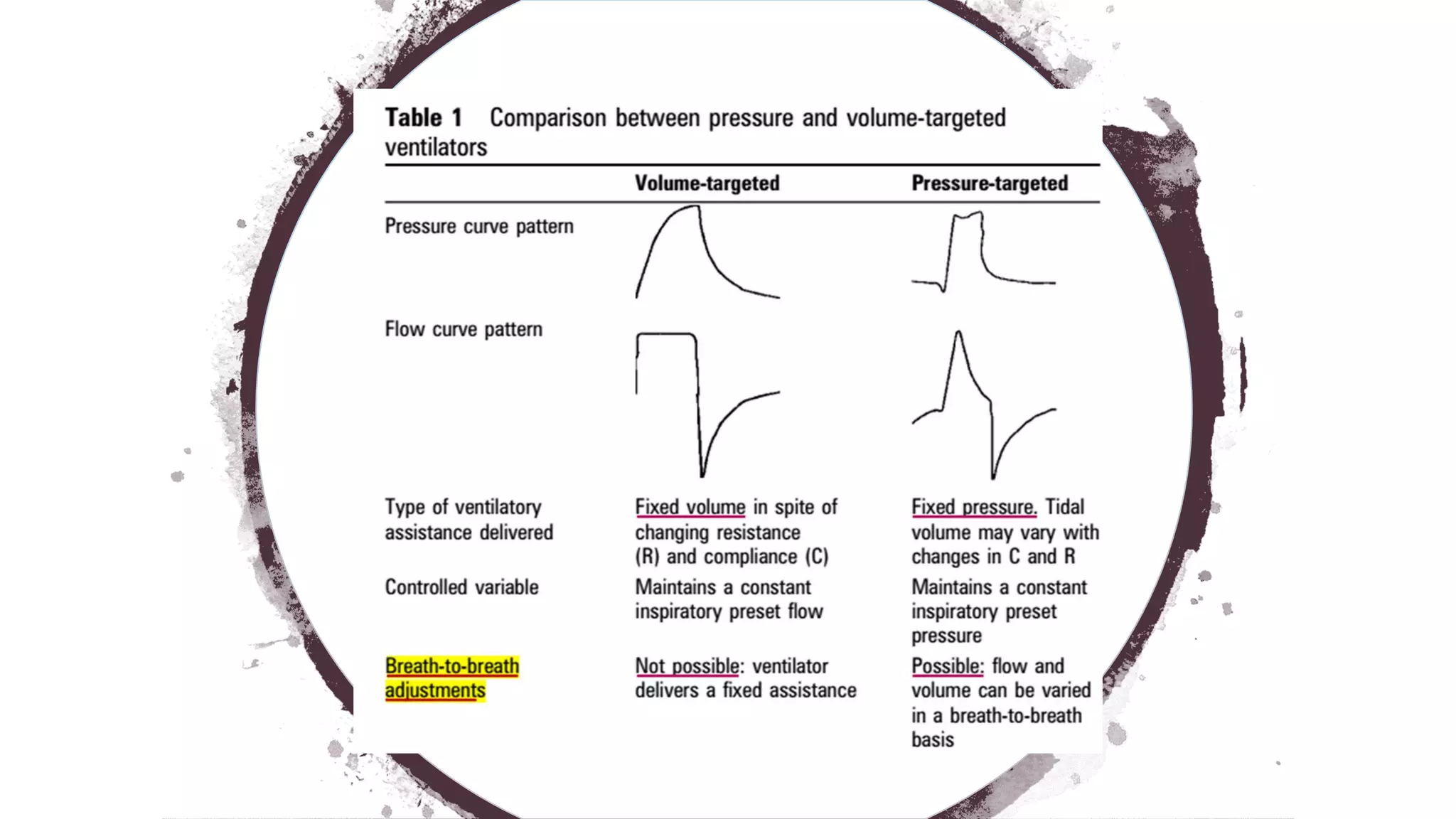 Niv ventilatory modes | PDF