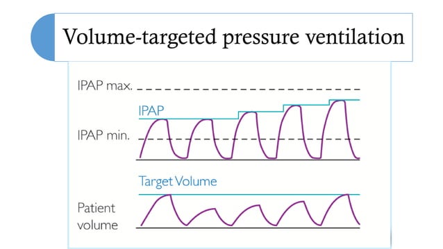 Niv ventilatory modes | PDF