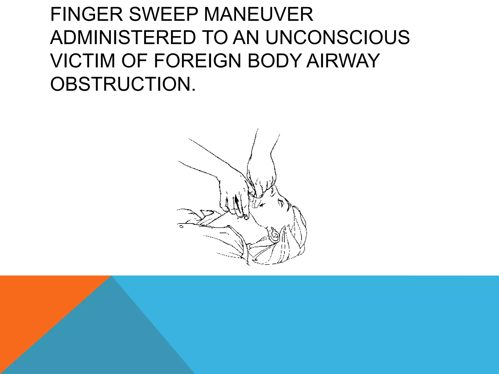 Airway obstruction with foreign bodies treatment in dental office | PPTX