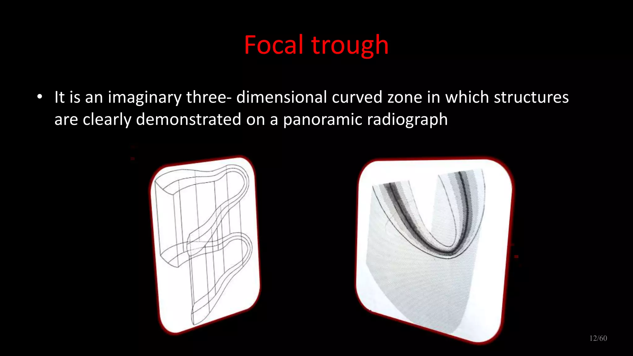 Panaromic radiography | PPTX