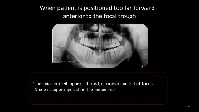 Panaromic radiography
