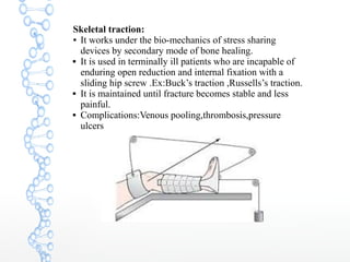 intertrochanteric fractures | ODP