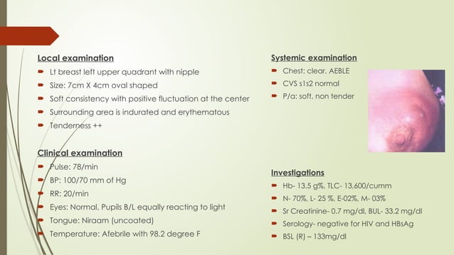 Case presentation of a BREAST ABSCESS.pptx