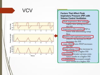 Nk mmc ventilation basics 2017 | PPTX