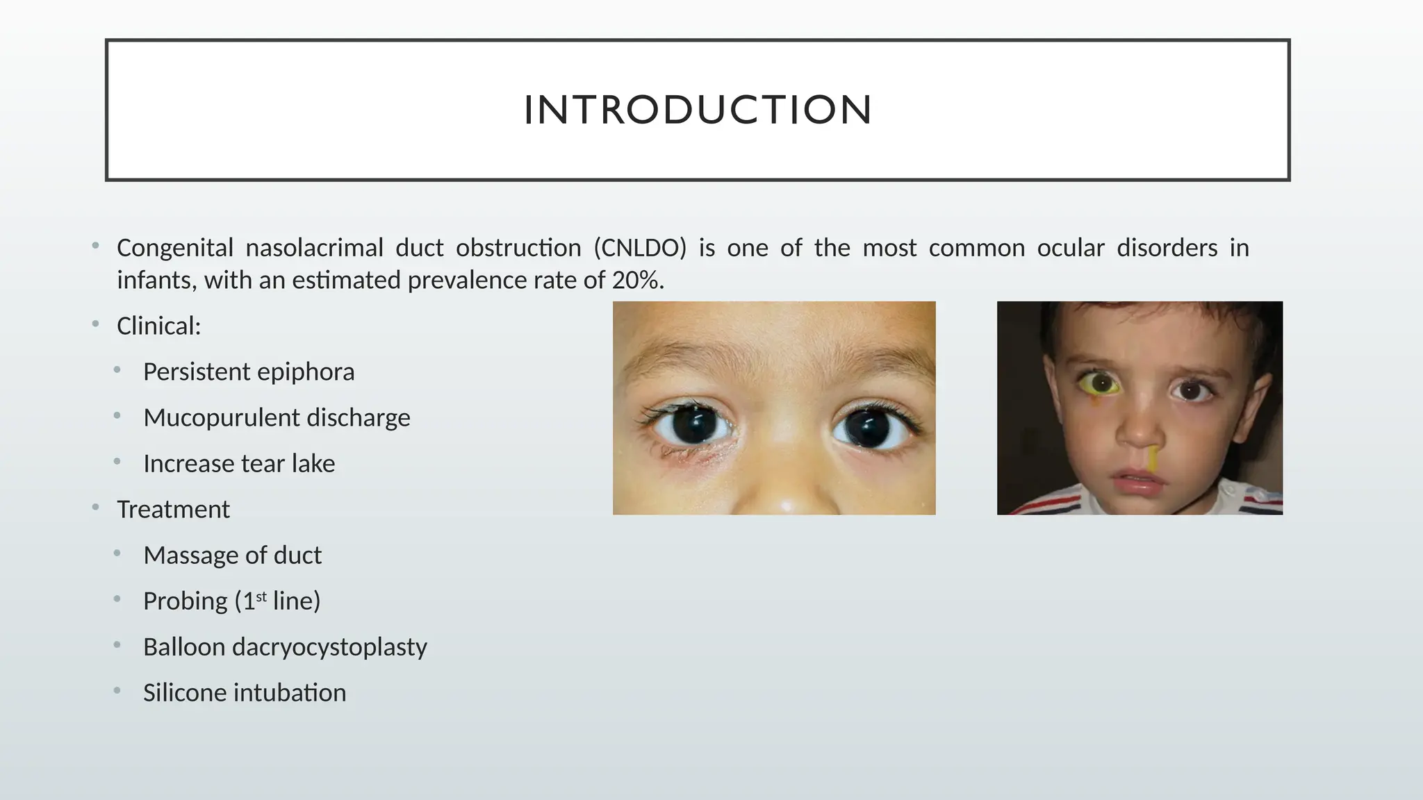congenital Nasalocarimal duct obstru.pptx