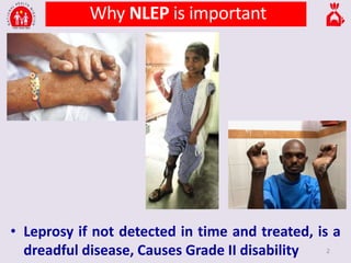 NLEP.ppt