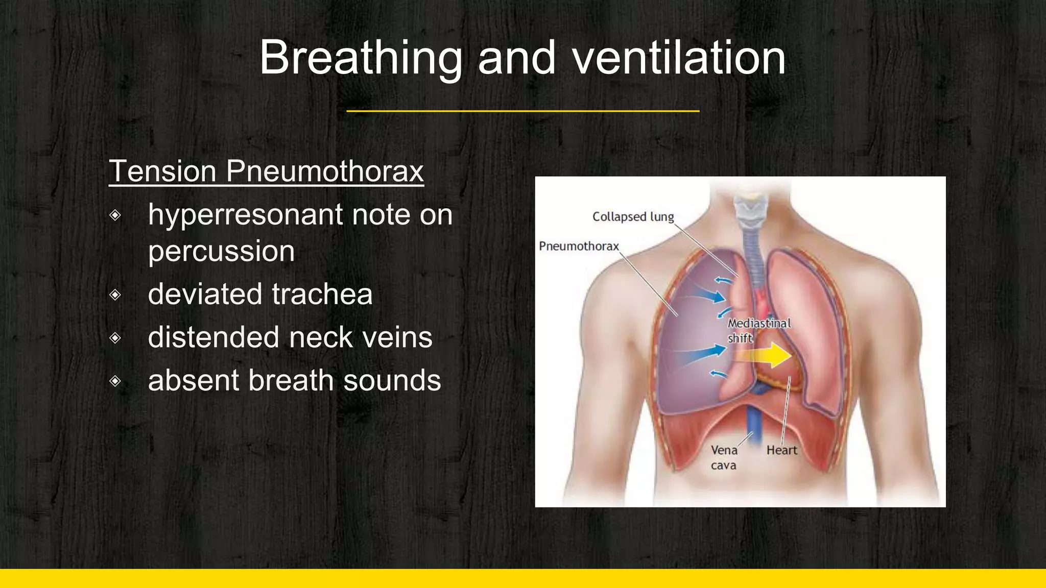 Initial Assessment and Management for Trauma | PPTX