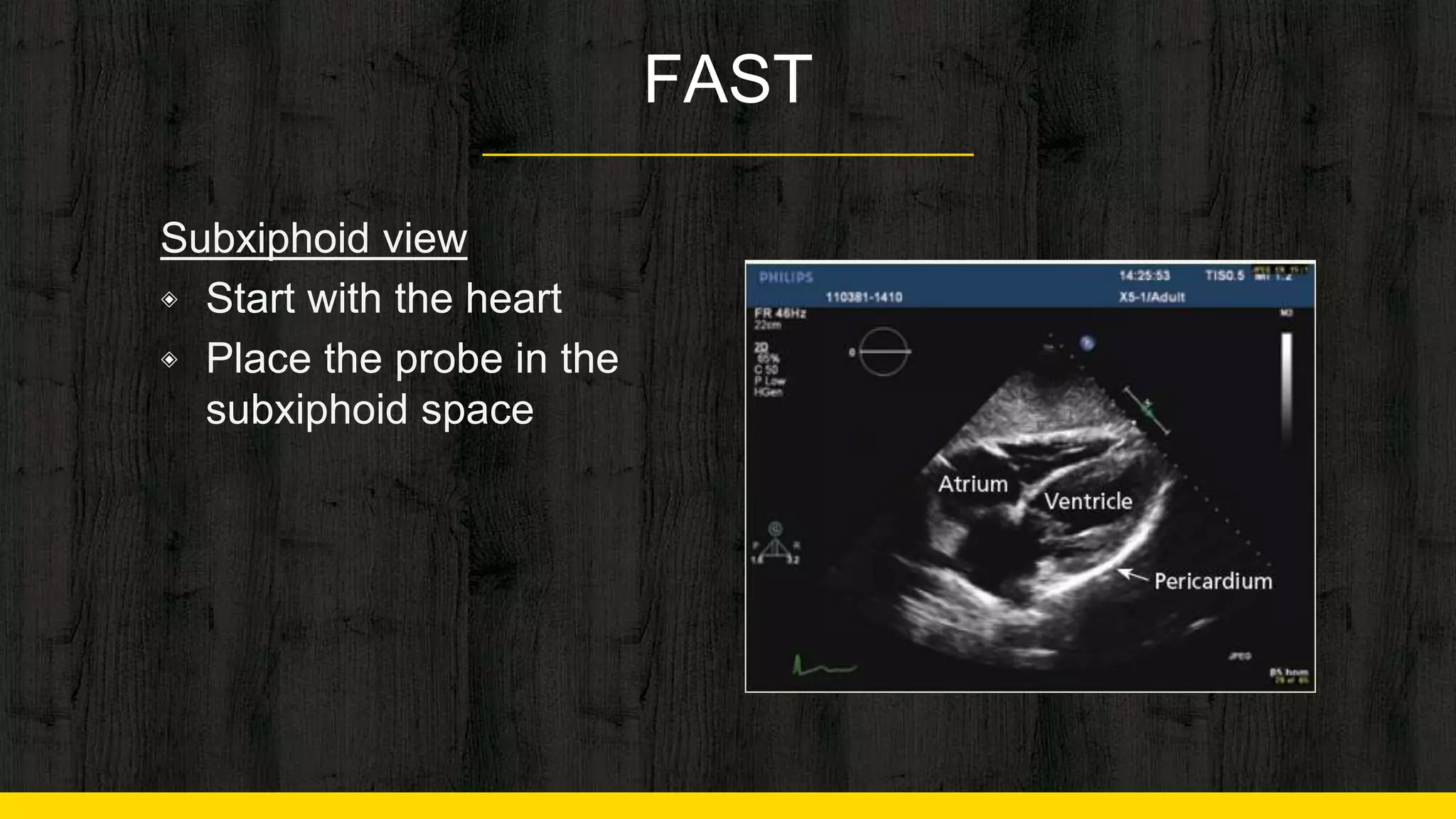 Initial Assessment and Management for Trauma | PPTX