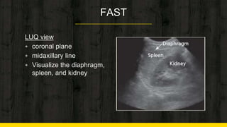 Initial Assessment and Management for Trauma | PPTX