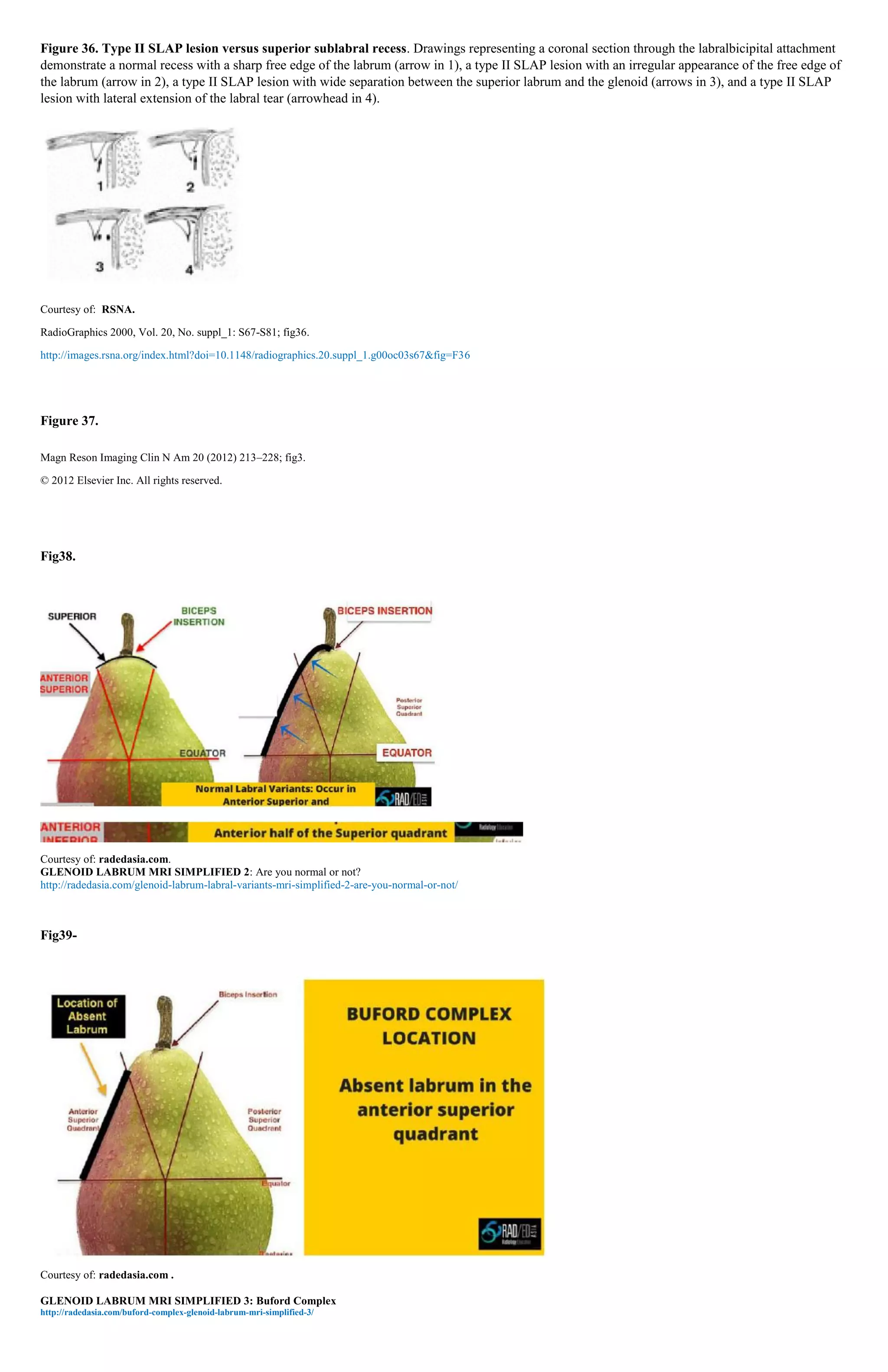 Normal Labral Variant Figures II - Walif Chbeir | PDF