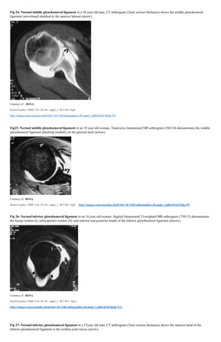 Normal Labral Variant Figures II - Walif Chbeir | PDF
