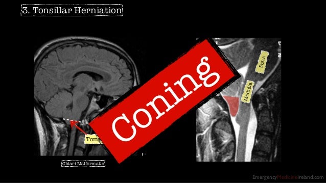 SMACC 2014 presentation