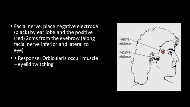 Neuromuscular Monitoring