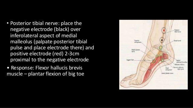 Neuromuscular Monitoring
