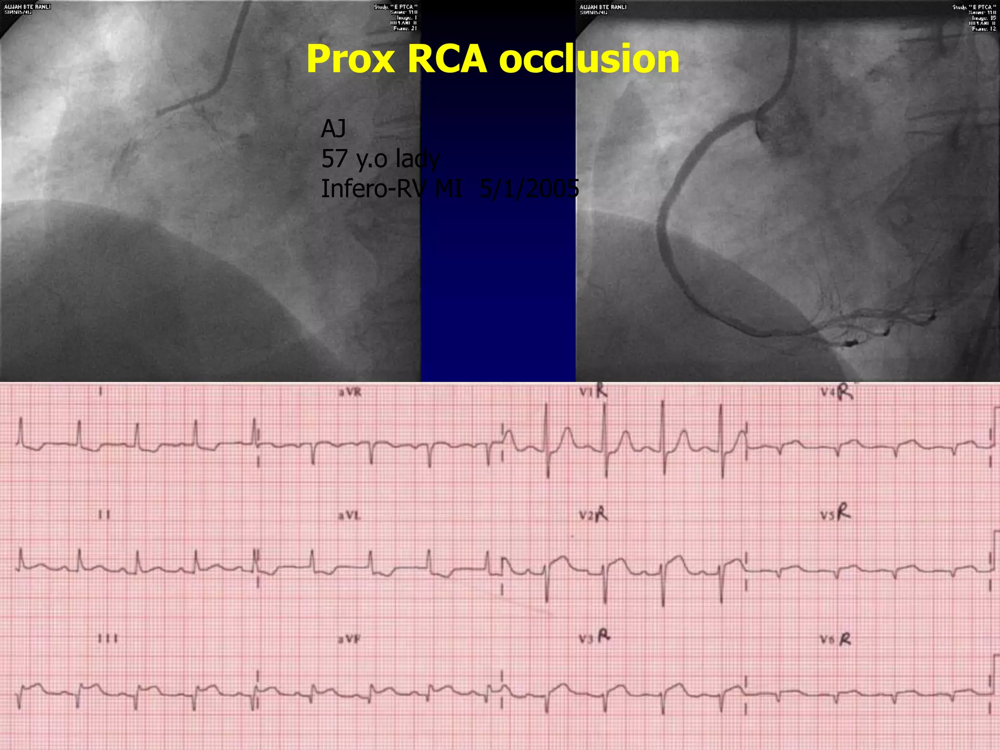 NMCT Cap. TS BS Hoai 2020.ppt