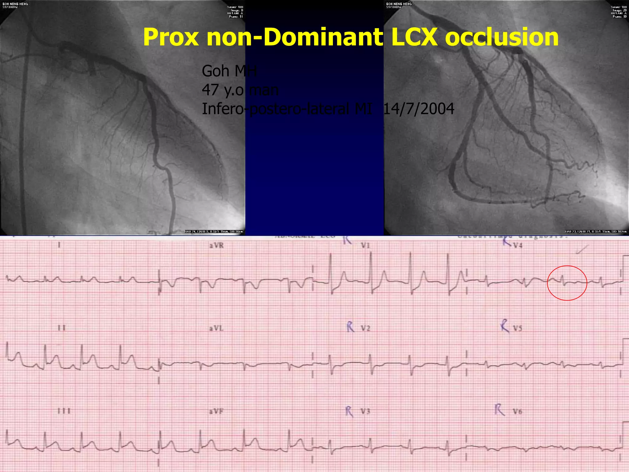 NMCT Cap. TS BS Hoai 2020.ppt