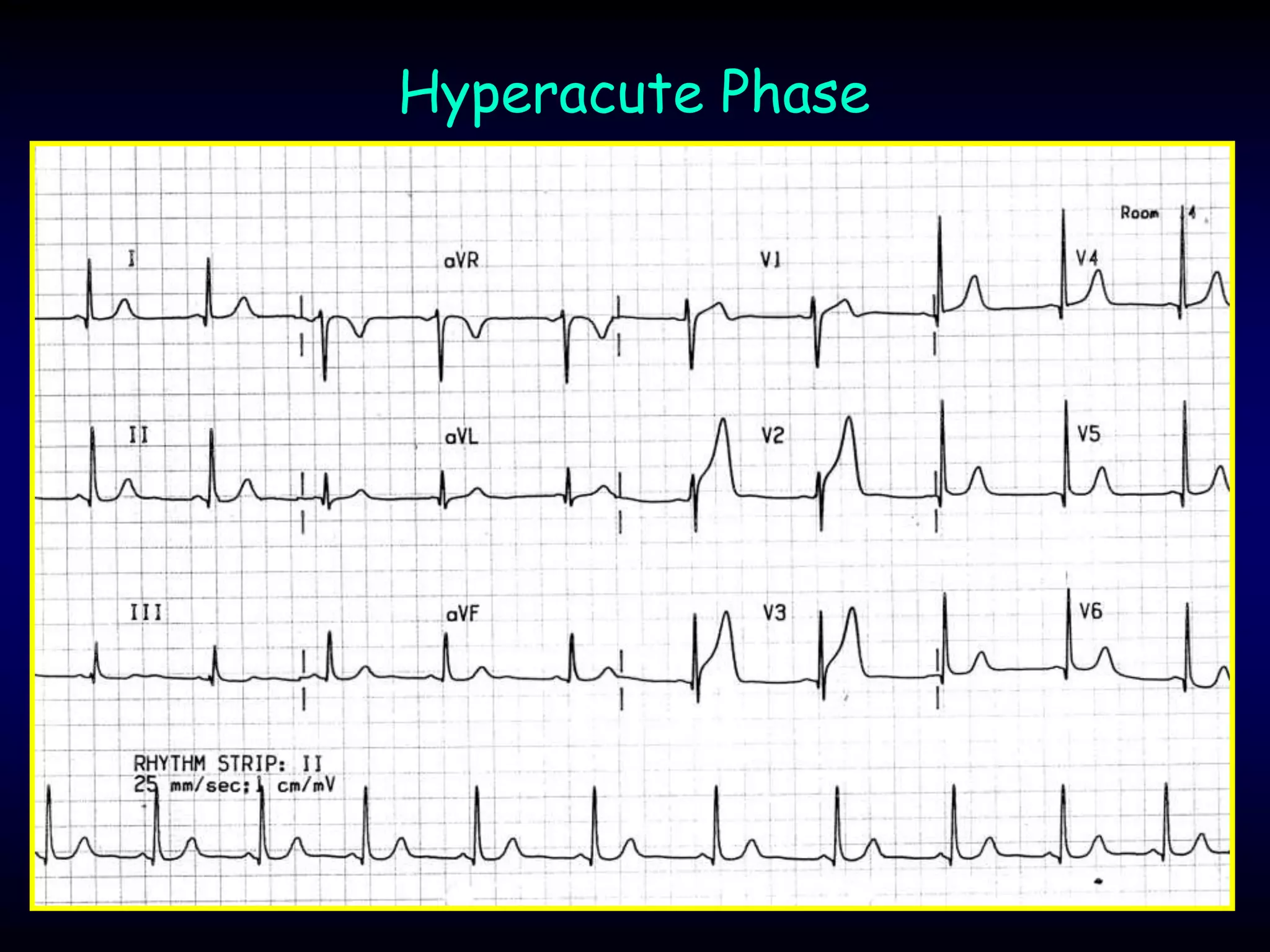 NMCT Cap. TS BS Hoai 2020.ppt