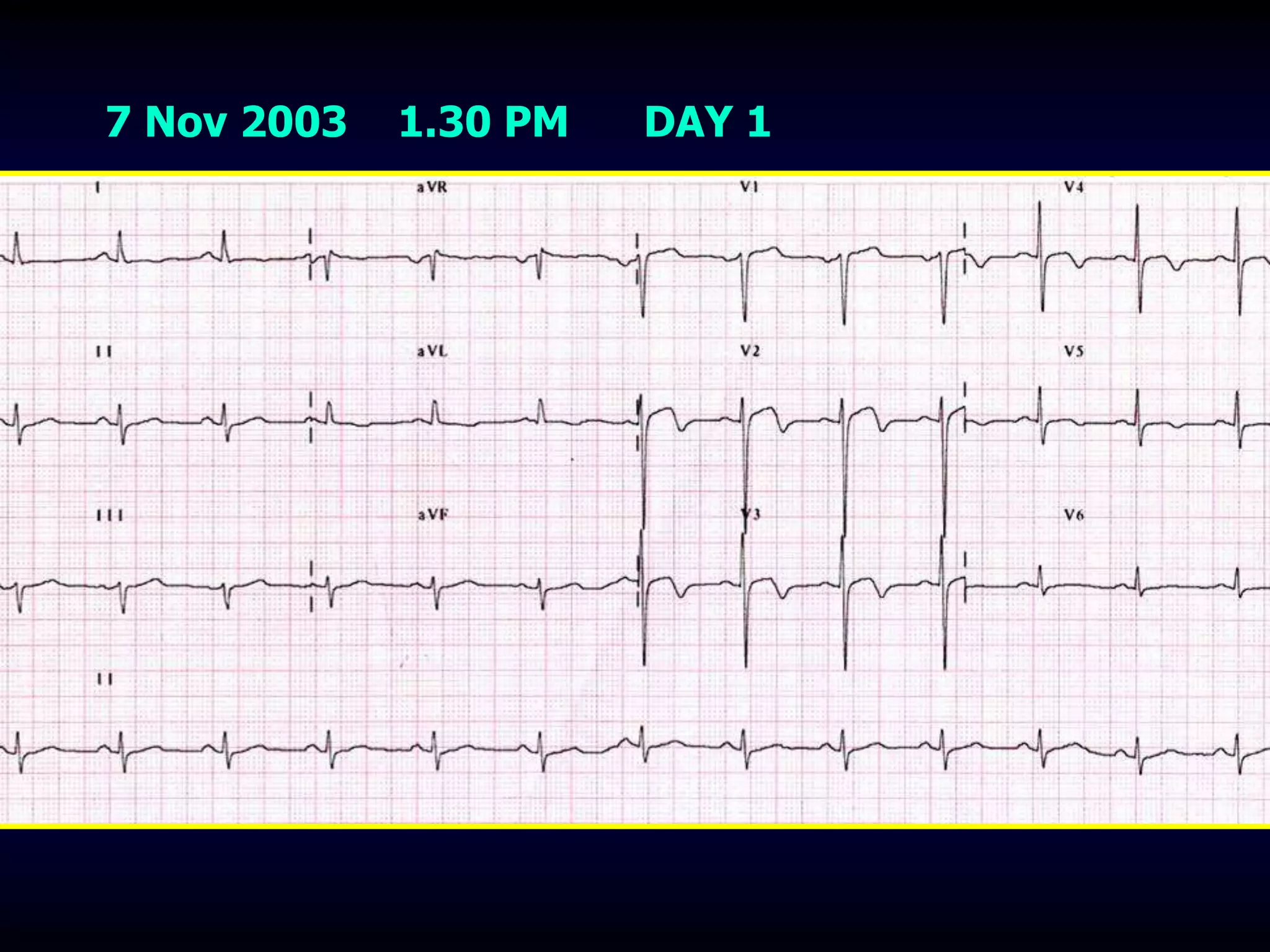 NMCT Cap. TS BS Hoai 2020.ppt