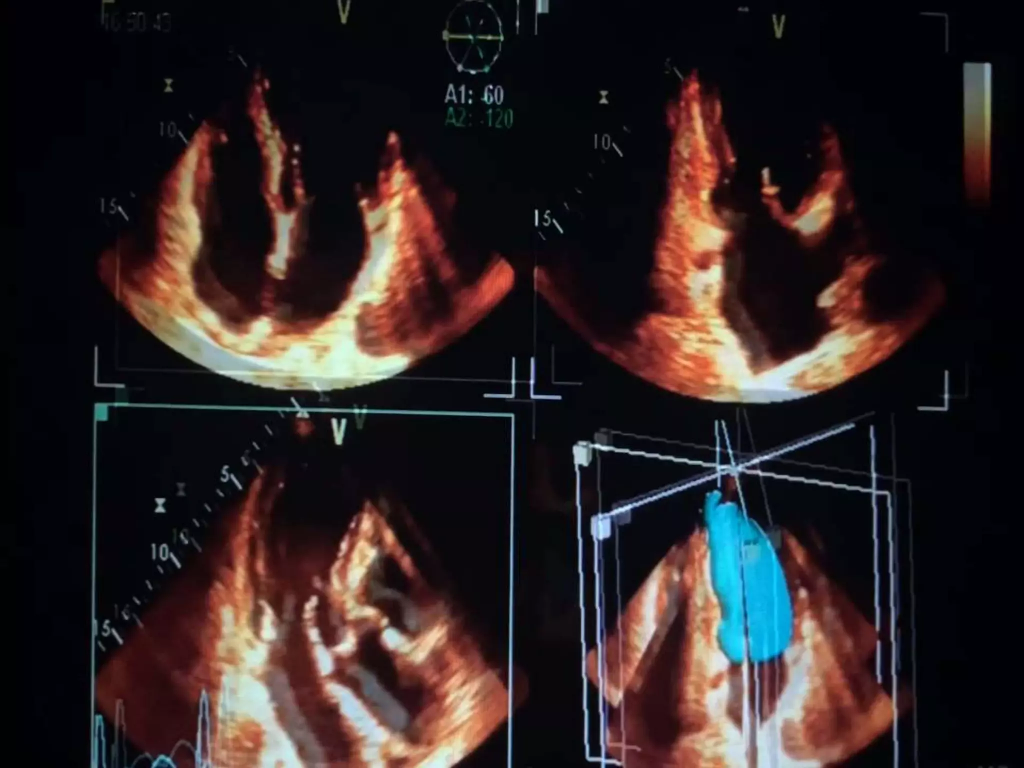 NMCT Cap. TS BS Hoai 2020.ppt